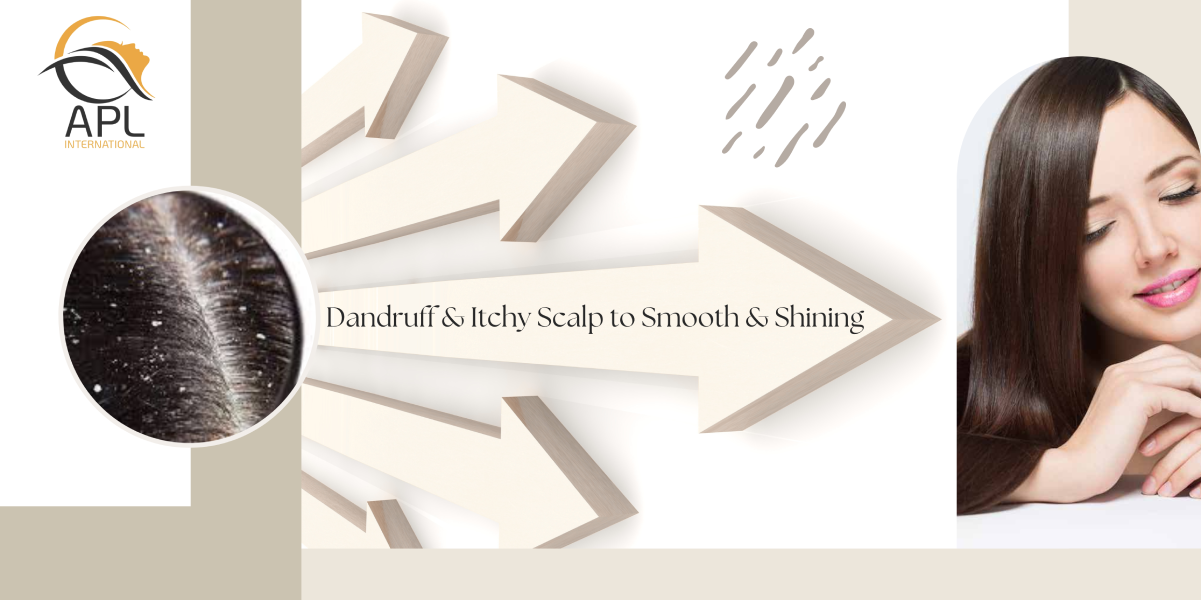 Simple Hair Care Tips to Control Dandruff & Itchy Scalp - aplinternational